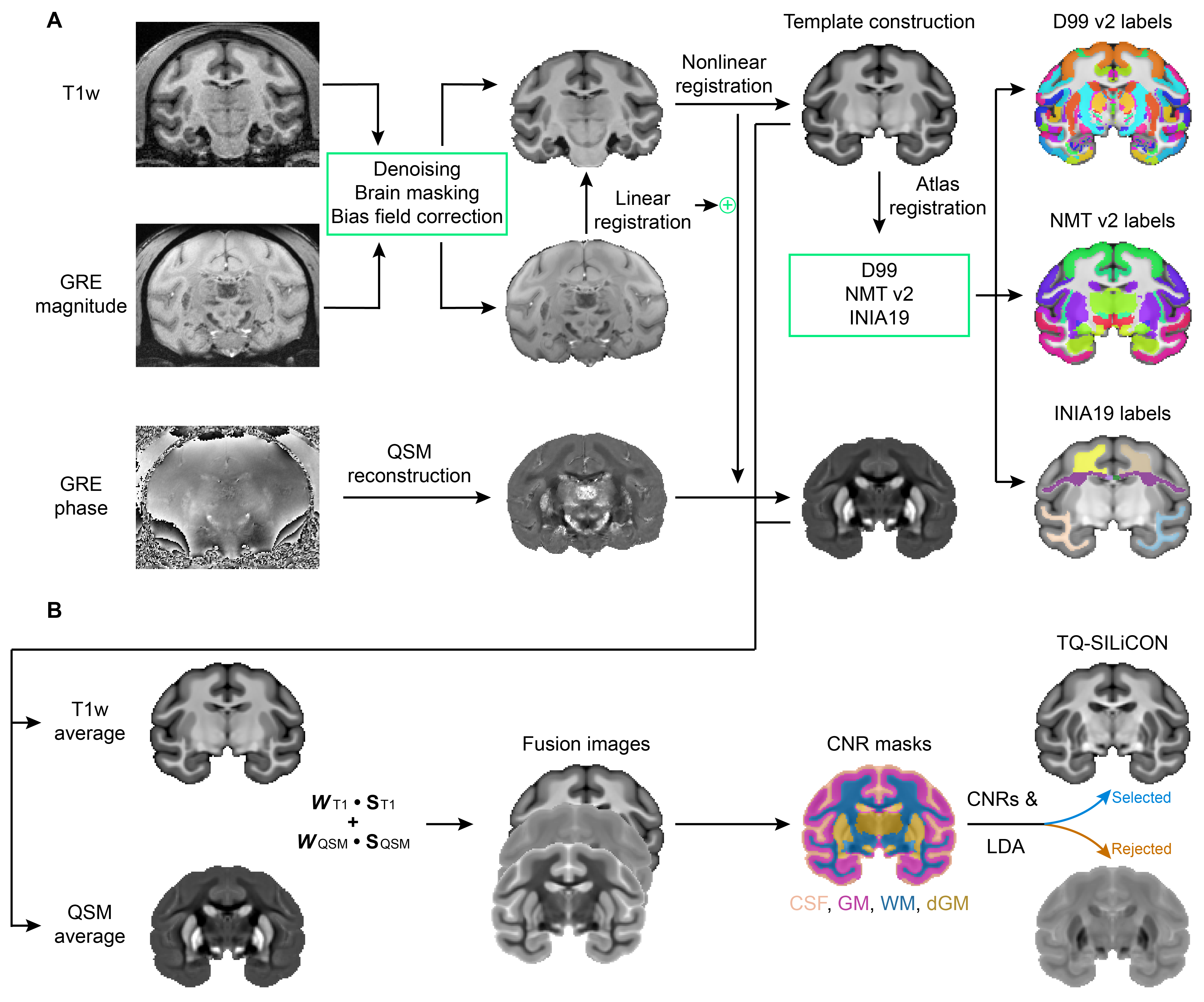 Fusion of quantitative susceptibility maps and T1-weighted images ...